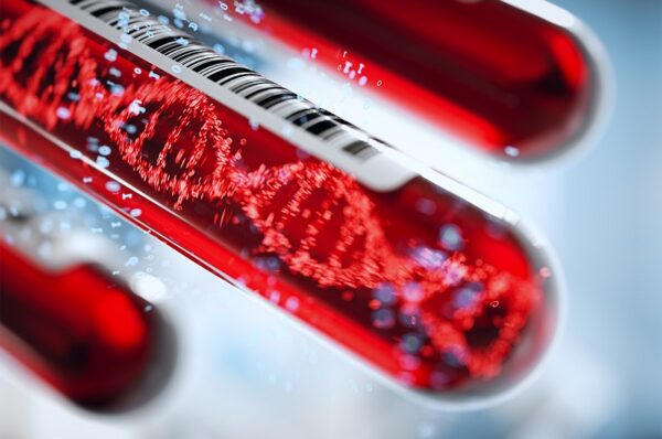 Grupo Fleury lança painel multigenes por biópsia líquida - Medicina S/A