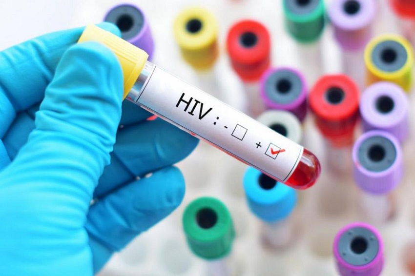 Dia Mundial de Luta contra Aids: Brasil tem 920 mil pessoas com HIV ...