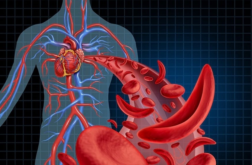 Projeto reconhece condição de deficiência para doença falciforme ...