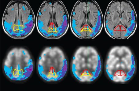 GE HealthCare adquire a MIM Software - Medicina S/A