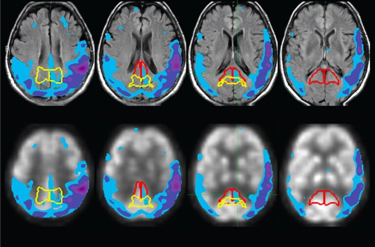 GE HealthCare adquire a MIM Software - Medicina S/A