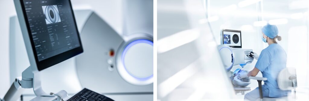 Laser de femtosegundo: evoluções da cirurgia refrativa na oftalmologia ...